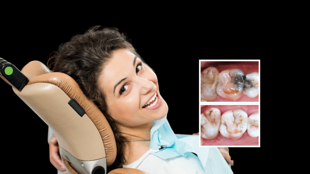 Mercury Removal Dentist London, Book Mercury Removal Here