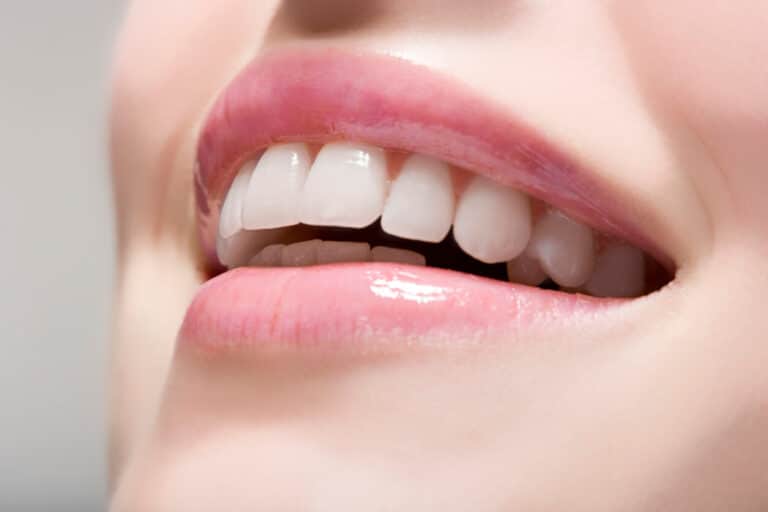 Peg Teeth: Causes, Treatment, And Symptoms | Smile Cliniq
