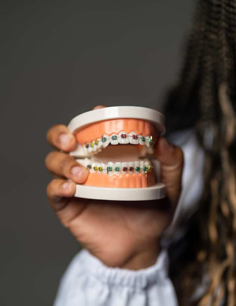 Damon Braces London
