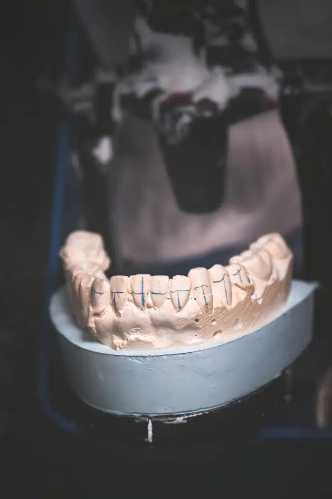 Cfast Braces - Smile Cliniq